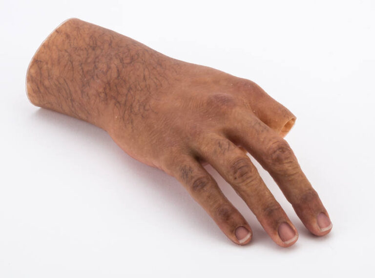 Finger Prosthetic Services | Finger Extensions - fingerprosthetics.com
