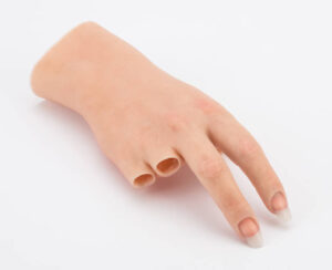 Finger Prosthetic Services | Finger Extensions New York ...