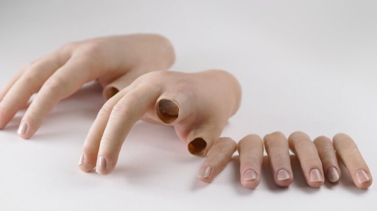 Custom Silicone Finger Prosthetics for Natural Look